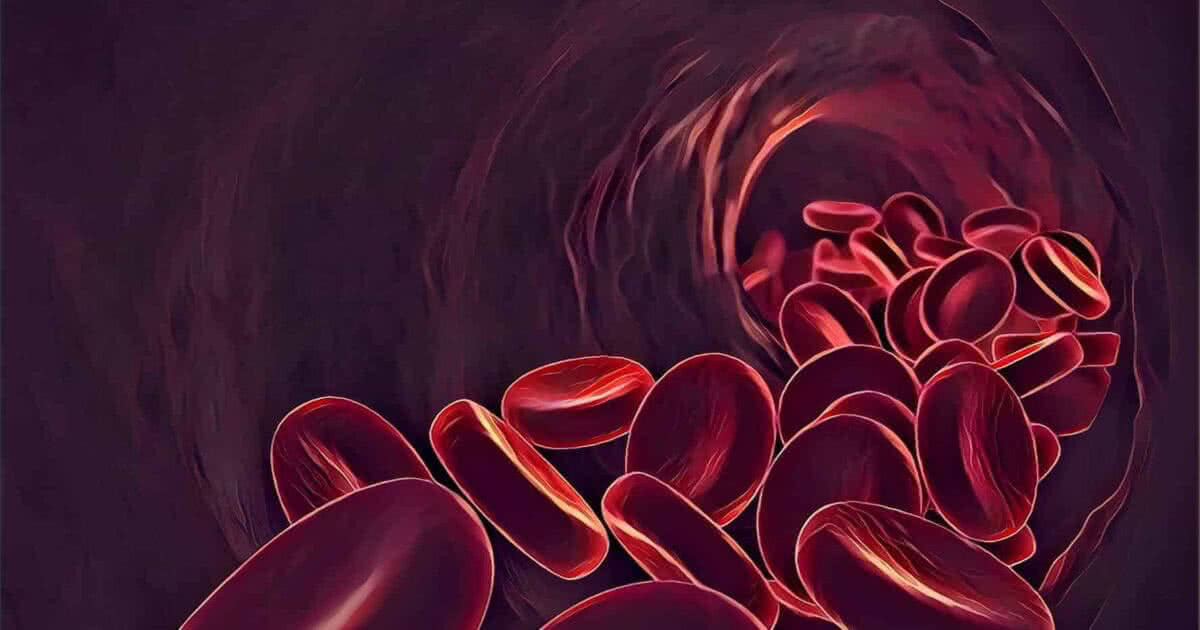 Coágulos de sangue (Trombo) - Vascular.pro