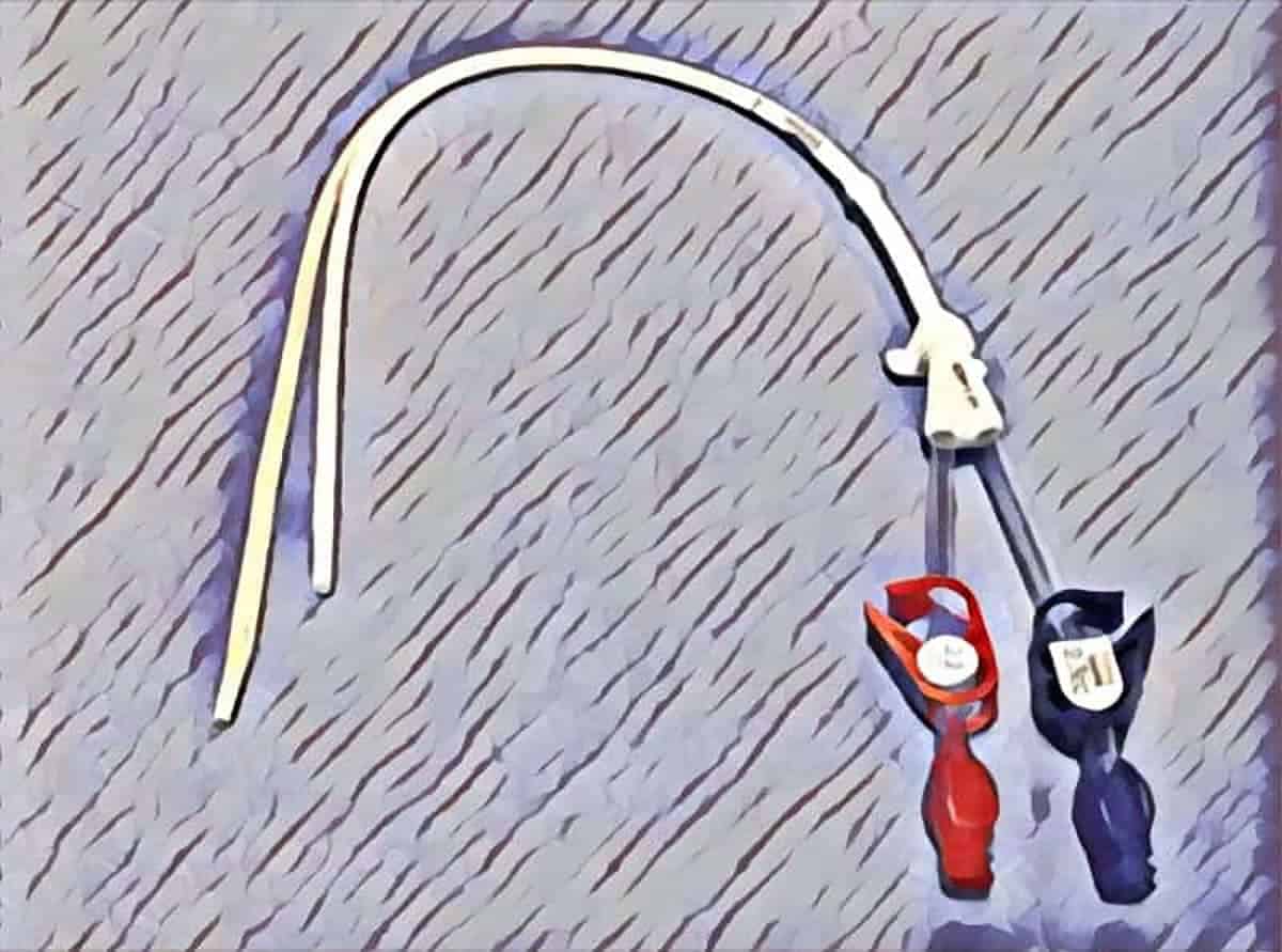 Permcath: o que é, como funciona e como é implantado para hemodiálise ...
