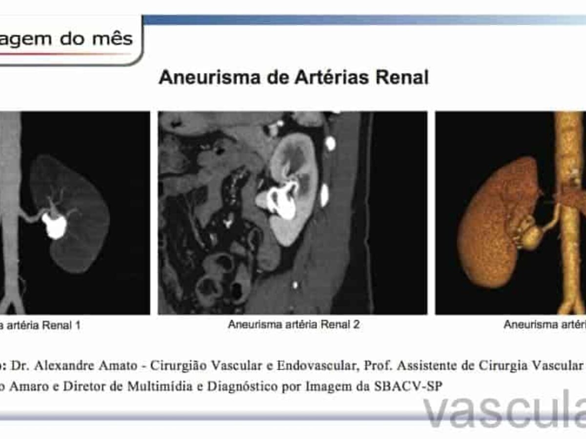 Disseccao Renal Humana