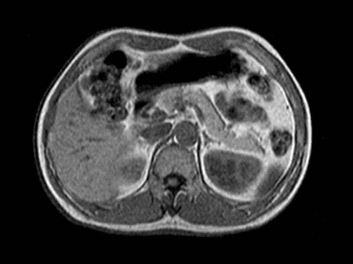 Ressonancia Magnetica Cerebral Saudavel Com Contraste RAIOMEDIC L