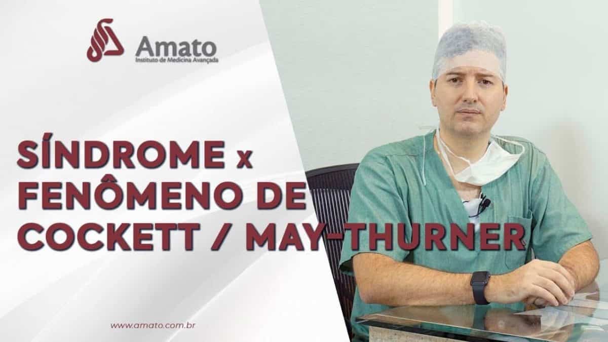 Síndrome de Cockett ou May-Thurner e varizes. - Vascular.pro