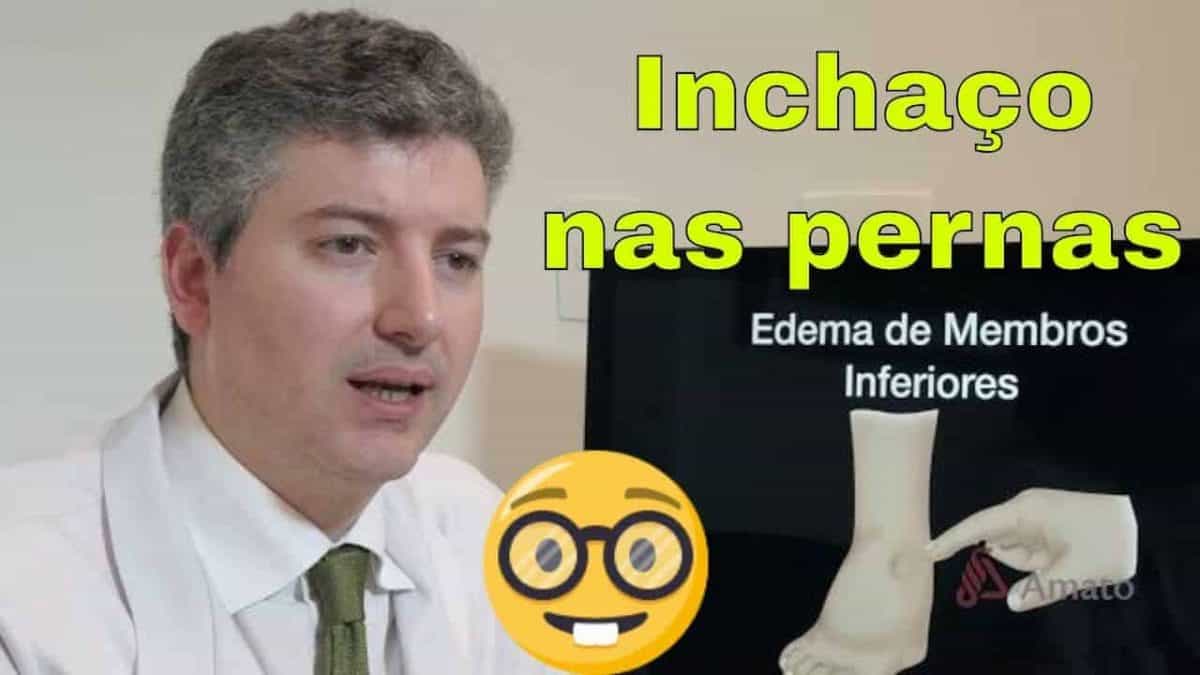 Edema periférico: saiba mais sobre o inchaço nas pernas e pés