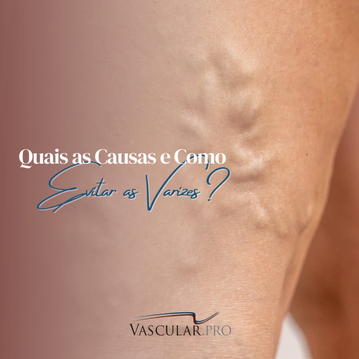 As causas da existência de veias doentes não são totalmente conhecidas ...