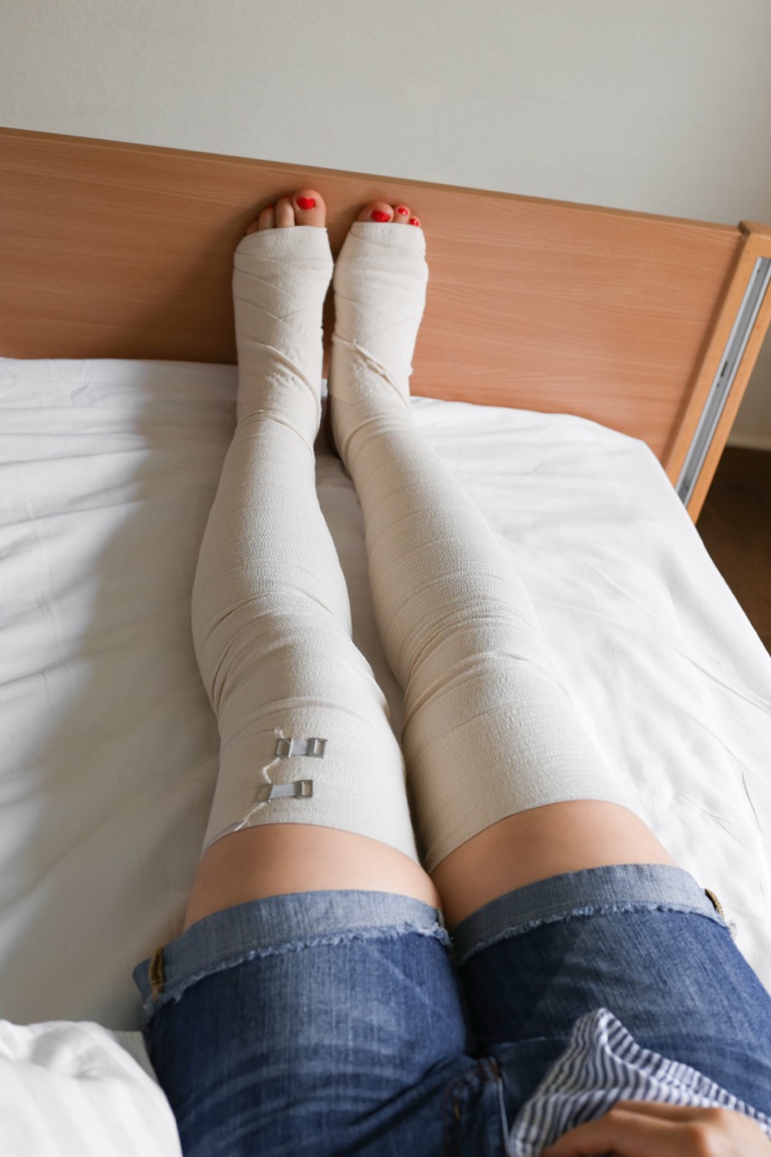 Meia de Compressão Pós-Cirurgia: Entendendo a Importância e o Uso ...